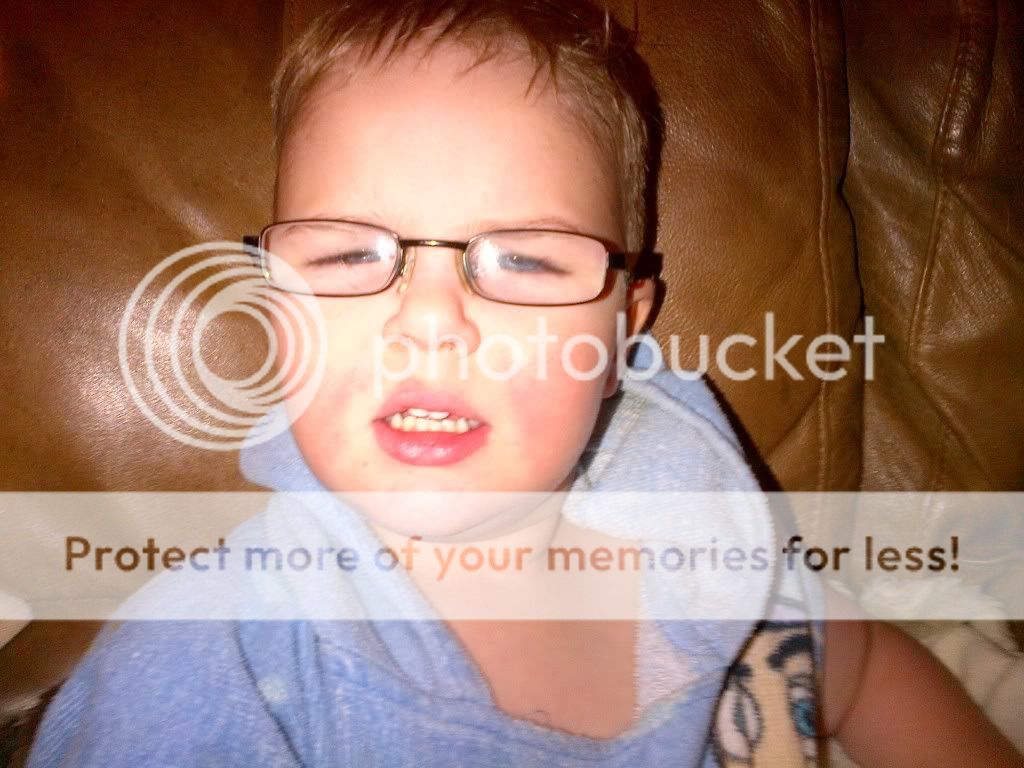 Slapped cheek syndrome? - BabyCentre